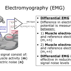 EMG Muscle Sensor Module for Arduino in Pakistan